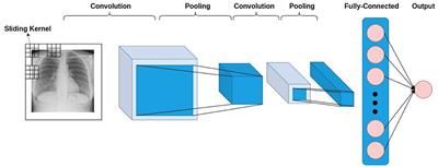 Frontiers | CCTCOVID: COVID-19 detection from chest X-ray images using Compact Convolutional ...